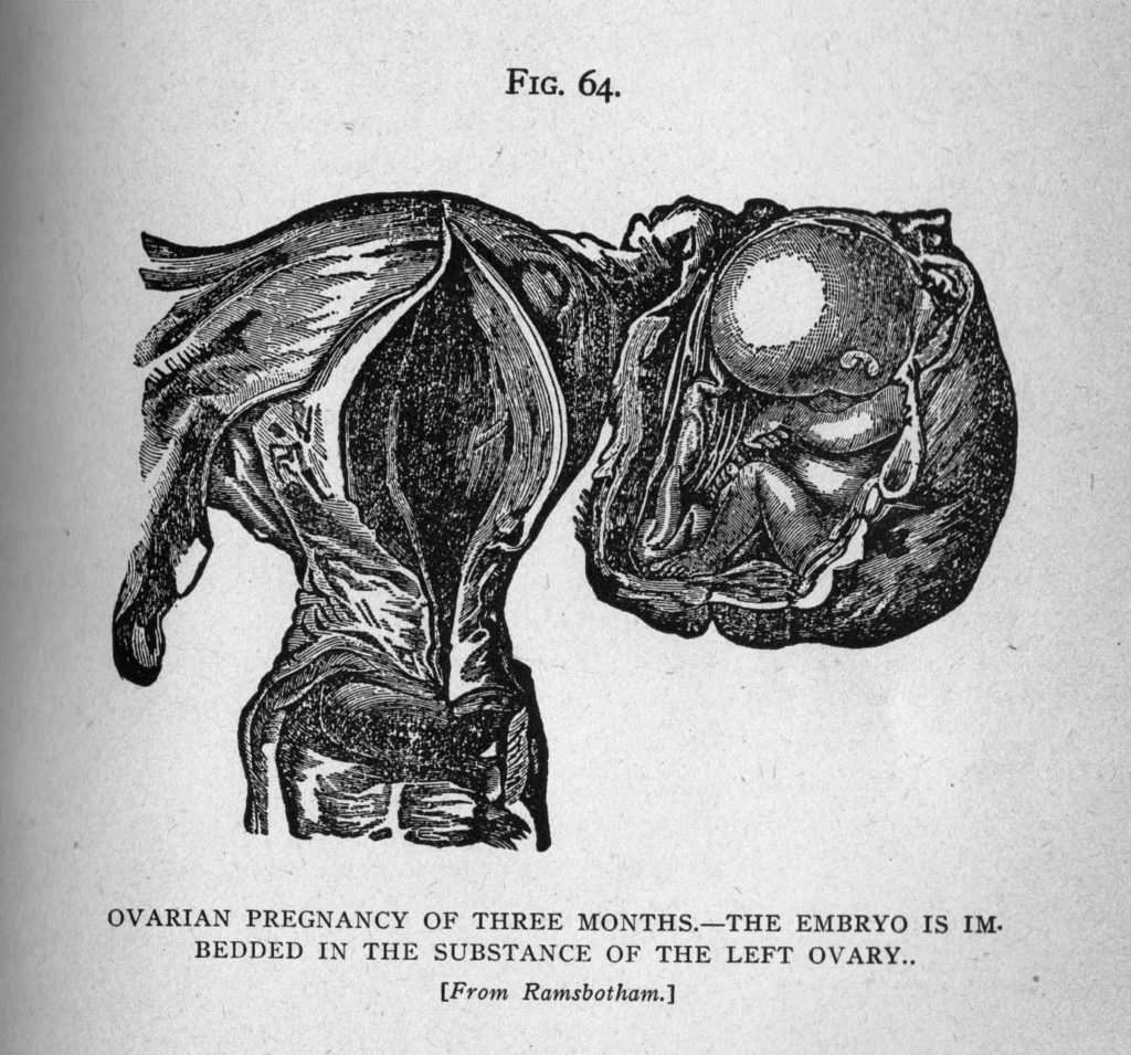 Antique Pregnancy Illustrations | A Cabinet for the Curious